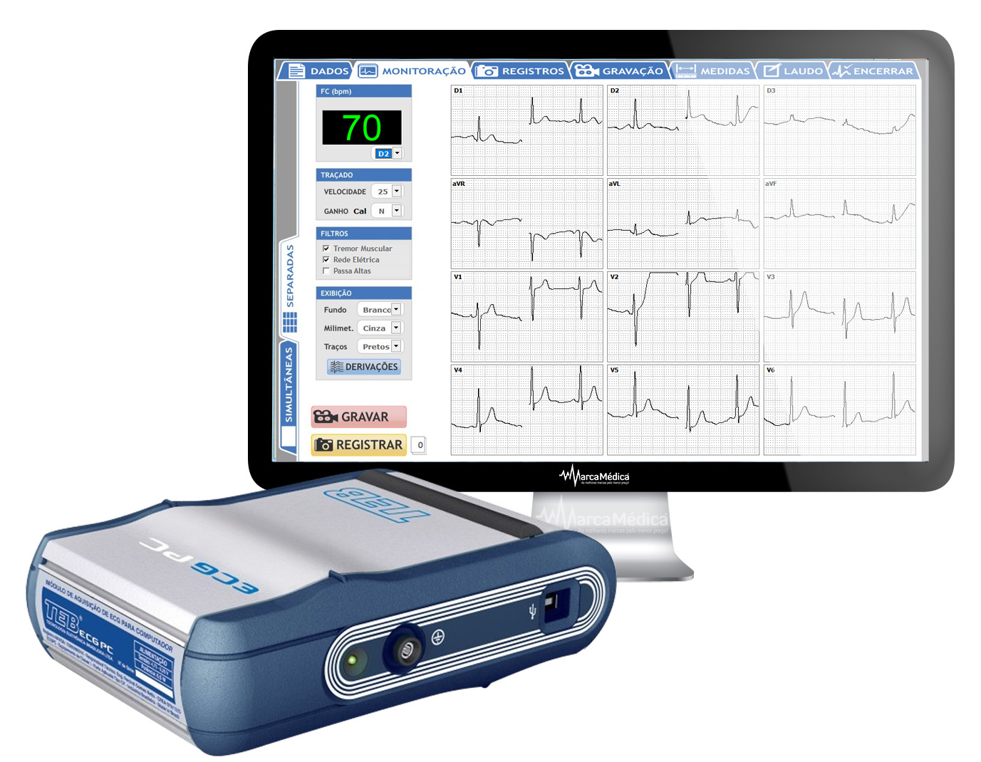 Eletrocardiógrafo de 12 derivações simultâneos para computador ECG PC - TEB